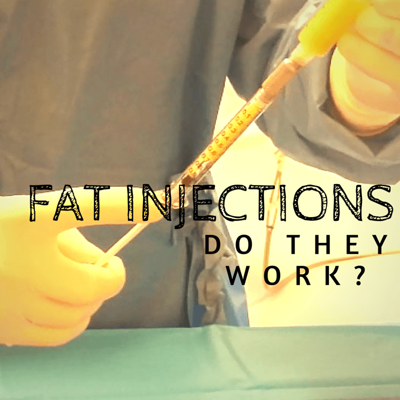 How Long Do Facial Fat Injections Last? | Dr. Brett Kotlus, Cosmetic ...